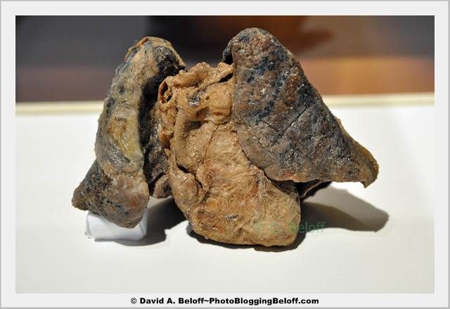 BODIES REVEALED gives us a rare look inside the human body – The ...